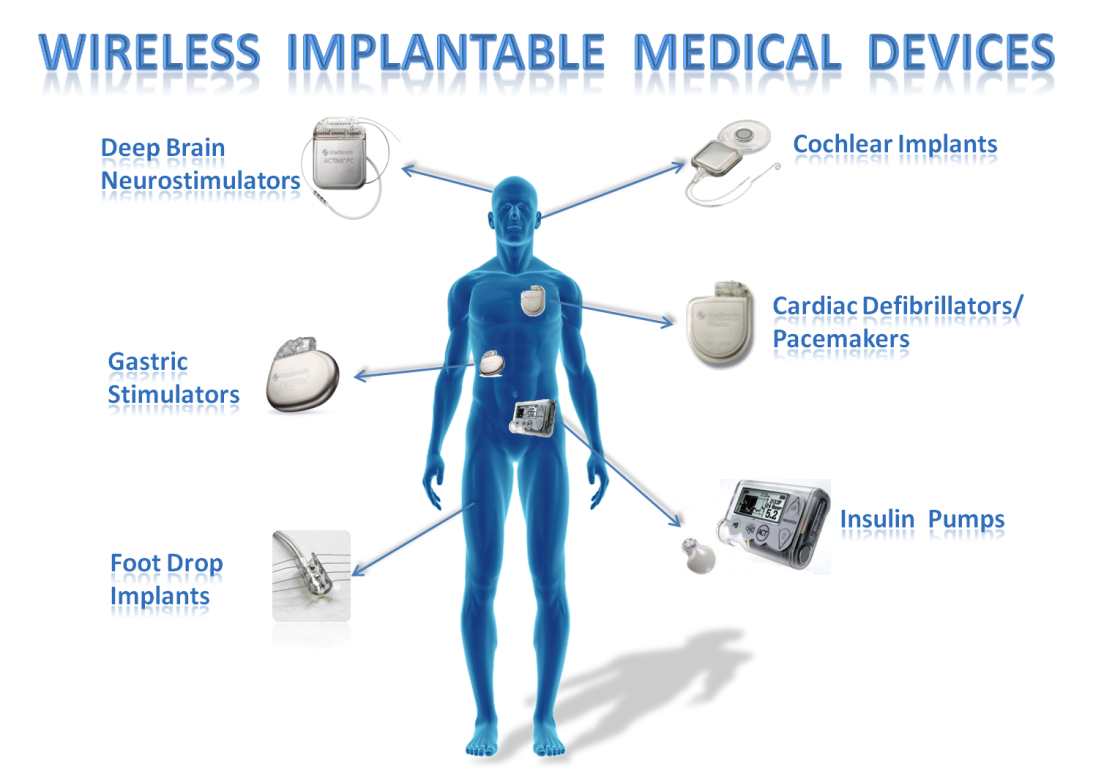History of Medical Developments in the Last 50 Years or so - The ...